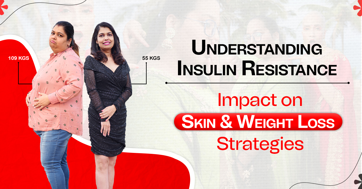 Understanding Insulin Resistance: Impact on Skin & Weight Loss Strategies - Indianweightlossdiet ...